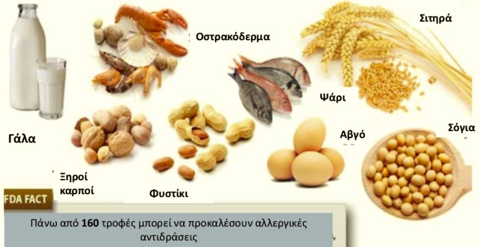 Τροφική αλλεργία: Συμπτώματα, αιτίες και διαδικασία SOTI - HealthyLiving.gr